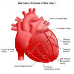 Coronary Heart Disease - Central Sydney Cardiology