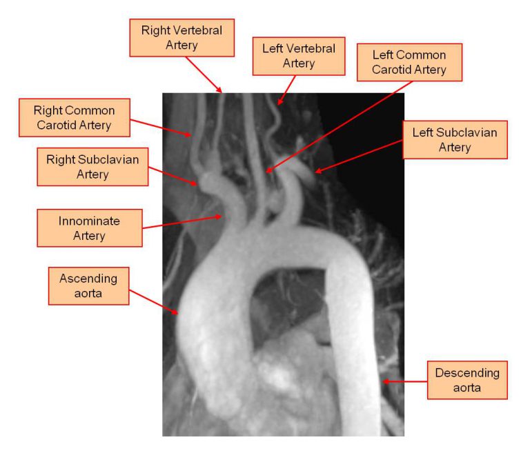Aortic Disease - Central Sydney Cardiology